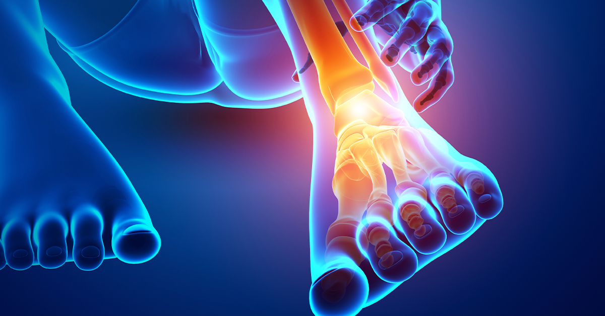 Ankle Pain Types - Nilssen Ankle