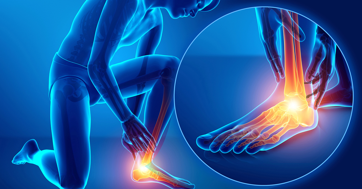 Can You Walk with a Pilon Fracture? - Nilssen Ankle